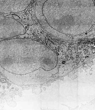 FAST-EM | Ultra-fast automated multibeam electron microscope